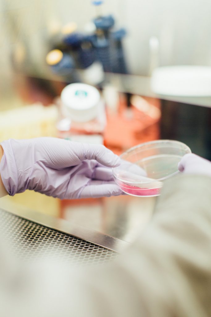 Urinalysis Urine Test Results Explained HealthEngine Blog
